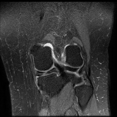 Radiology Cases: June 2009