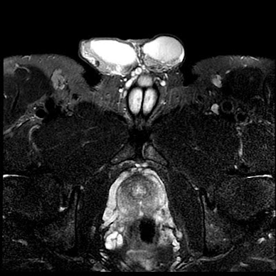Radiology Cases: September 2009