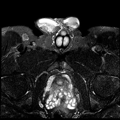 Radiology Cases: September 2009