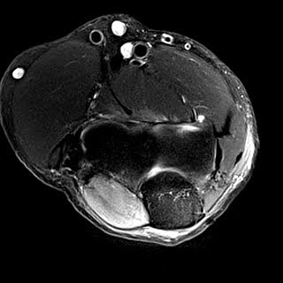 Radiology Cases: 2009