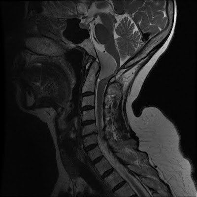 Radiology Cases: June 2010
