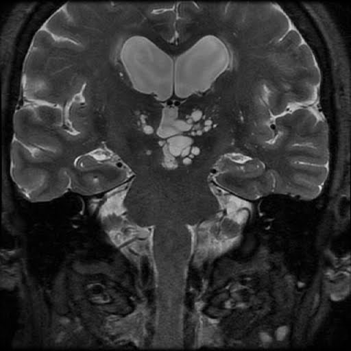Radiology Cases: June 2010