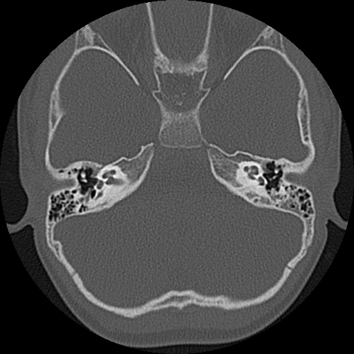 Radiology Cases: October 2010