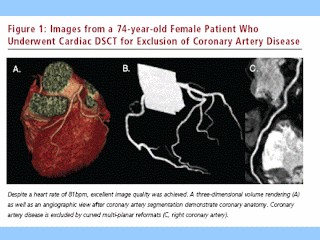 My Radiology World: Dual source ct