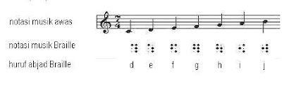 Notasi Musik Braille