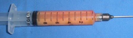 subincision - JungleKey.fr Image #250