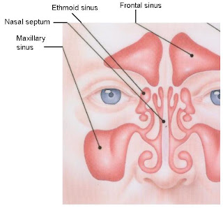 Sharkland: Aerosinusitis @ Barosinusitis