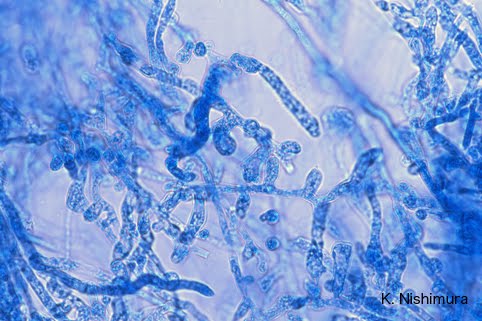 Parasite of the Day: May 19 - Pythium insidiosum
