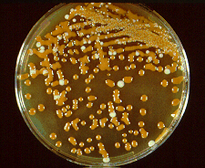 Parasite of the Day: April 25 - Cryptococcus gattii