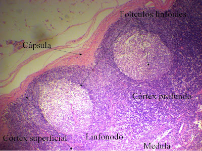 Diagrama De Linfonodo No Peito