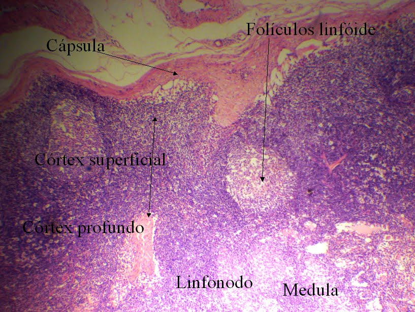 Linfonodo