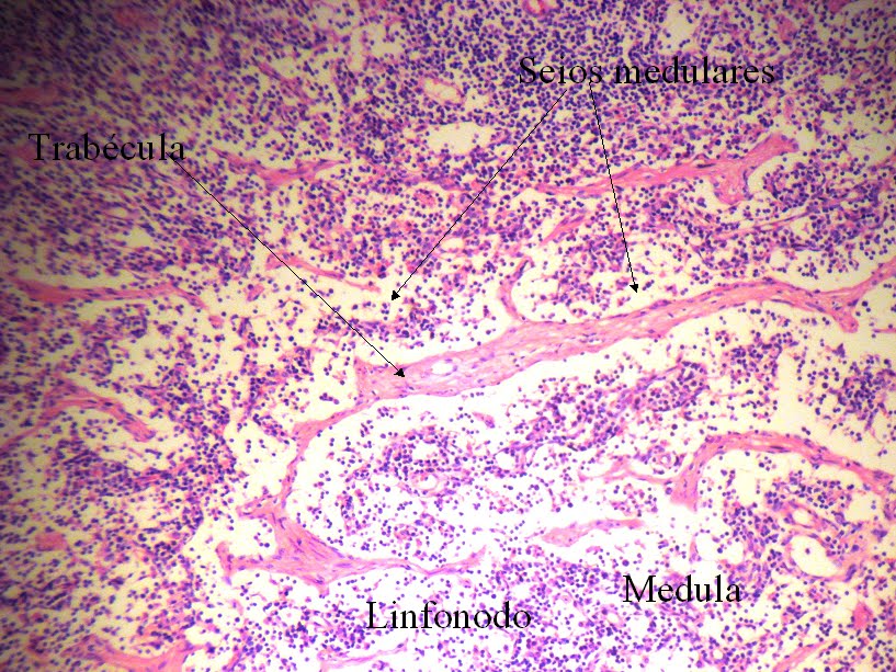 HISTOLOGIA-UFGD: (IM45) LINFONODO, (400X)