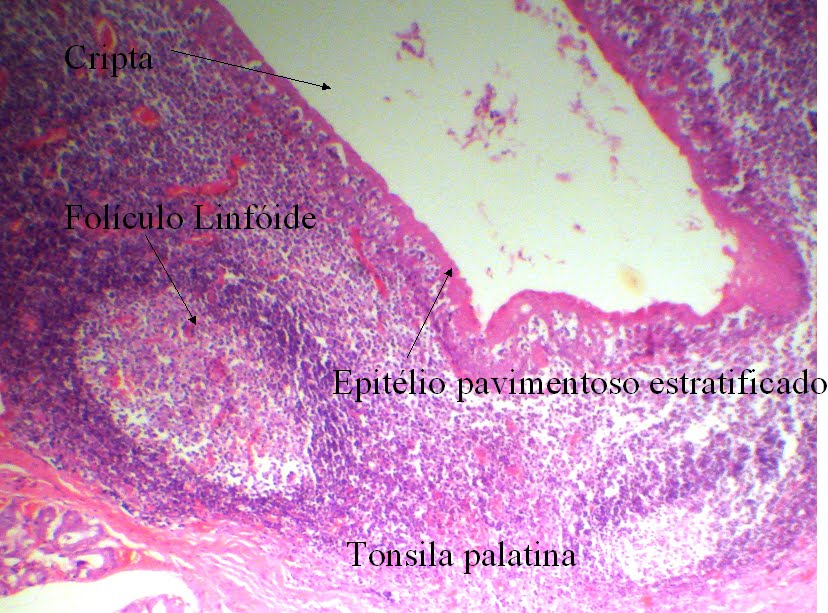 HISTOLOGIA-UFGD: (IM50) TONSILA PALATINA, (100X)