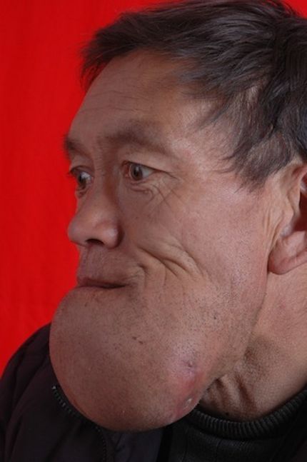 O homem com o maior queixo do mundo ~ VIDA ESTRANHA