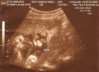 Baby on the way: The 8th Month