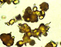 Laboratorium Kesehatan: Urinalisis 2 (Analisis Mikroskopik)