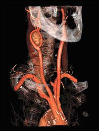 CT_physics_2009: Purpose of bolus tracking in contrast administration,