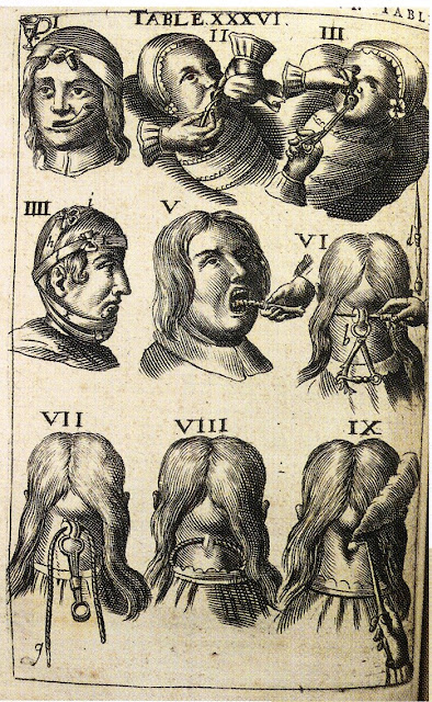 BOOKTRYST: Health Care Reform in 1655 - Surgical Ward