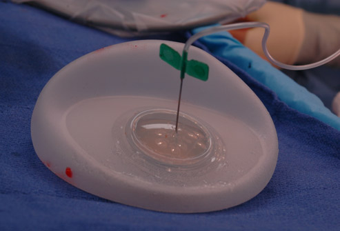 Never Lose Spirit: Life's Been Saved. Today Body Restored