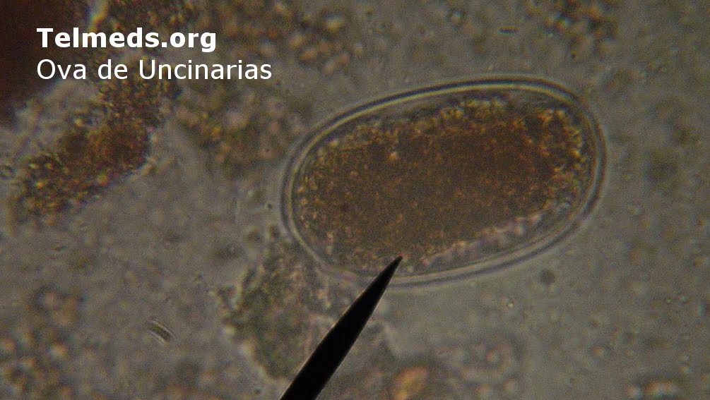 bacteriology: uncinaria