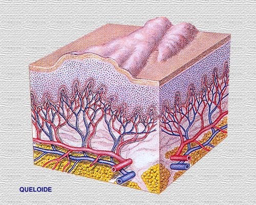 Estudiantes Vialenses de Ciencias Medicas: Atlas de Lesiones ...