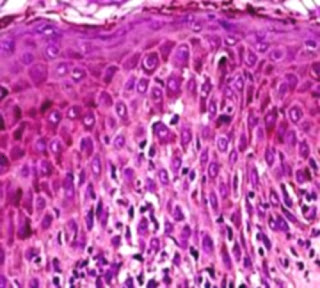 Dermatopathology Cases
