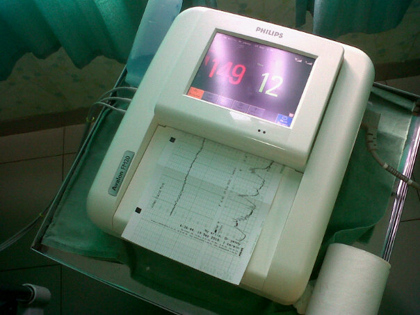 Wirausaha Keluarga: Persalinan Bunda dan CTG #1