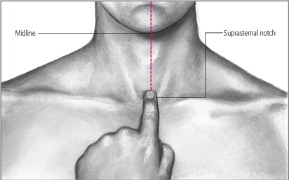 Dunham's Martial Arts: Introduction to Fancher's Street Edge: Self ...