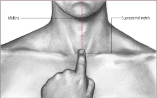 KENPO CLASS: Introduction to Fancher's Street Edge:Self Defense Systems