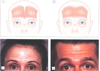 Skin Care Without Cosmetic Surgery: Botox Therapy: Anatomy of the Face