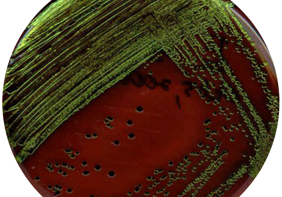 Microbiology: Genus: Escherichia (on EMB agar)