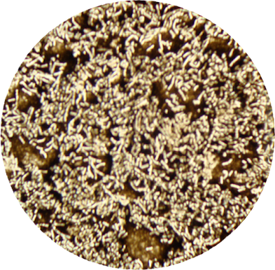 Microbiology: Staining Techniques