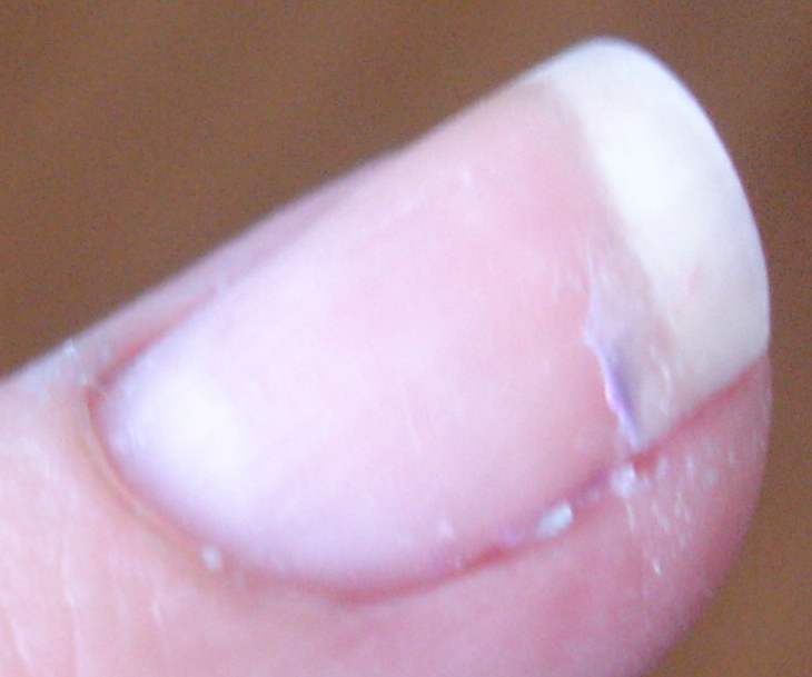 Polishology: Broken Nail Disaster and Repair Job