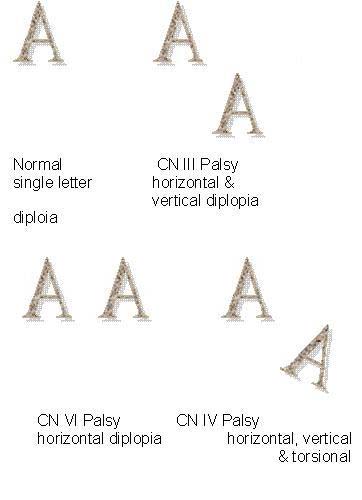 I was blind, but can I now see?: Double Vision ~ Double Prism