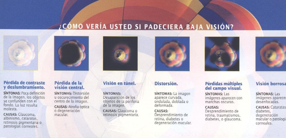 Accesibilidad en la Web: Problemas de baja visión