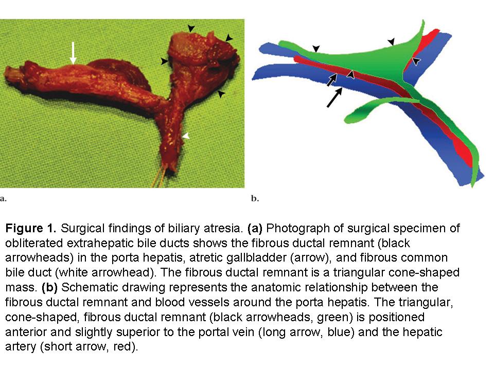 BÀI SOẠN VỀ SIÊU ÂM CHẨN ĐOÁN: TEO ĐƯỜNG MẬT và SIÊU ÂM CHẨN ĐOÁN