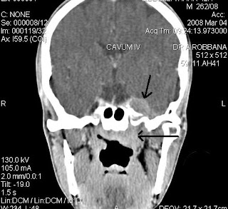 Centre d'Echographie et de Radiologie de Tunis: mars 2008