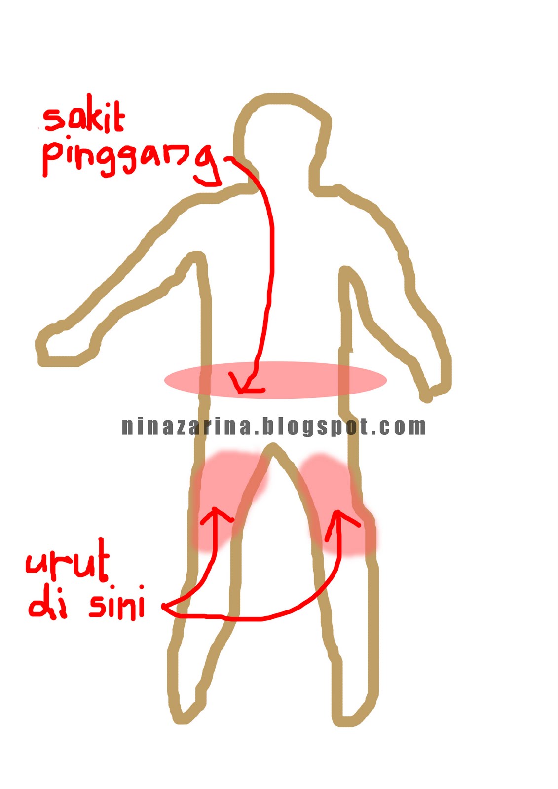 Nat Is Neat Penyelesaian Kepada Sakit Pinggang