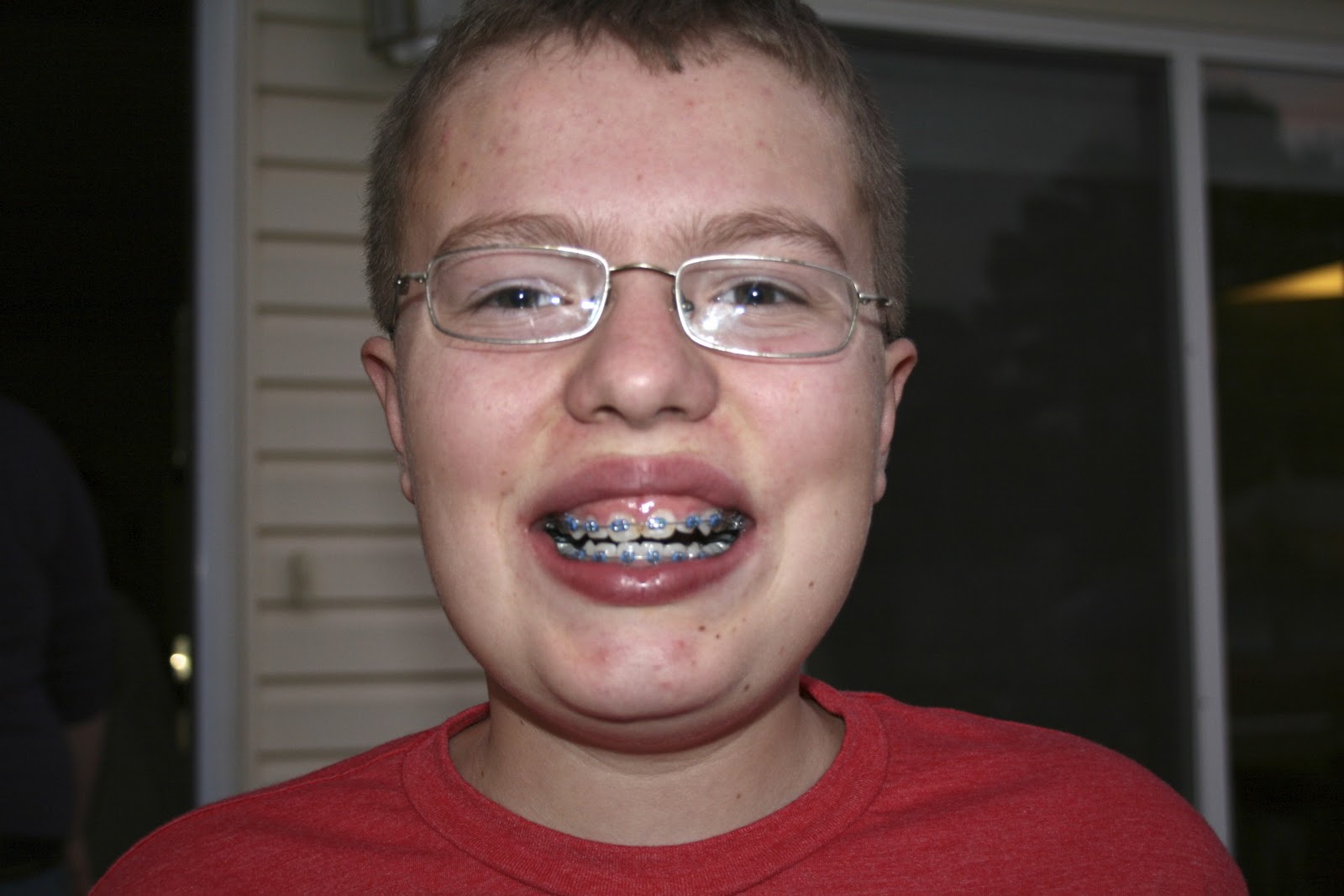 What Were We Thinking?: Brace Face!!!