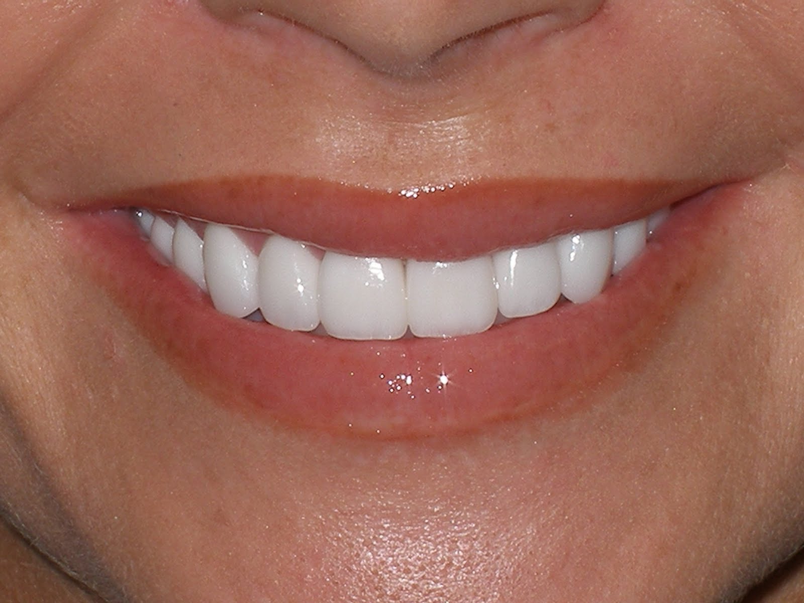 The World of Dentistry: A good smile becomes great