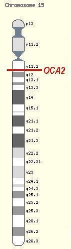 Sandwalk: Human OCA2 Gene Is Responsible for Eye Color and Skin Color