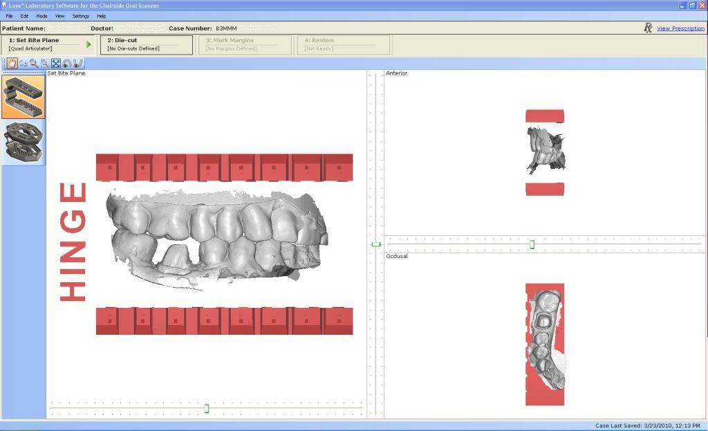 Lava Precision Solutions: New Lava™ Lab Software 2.6 for Chairside Oral ...