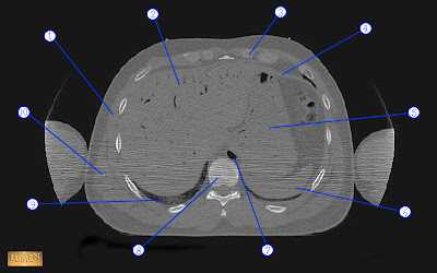 CT PHYSICS2009: March 2009