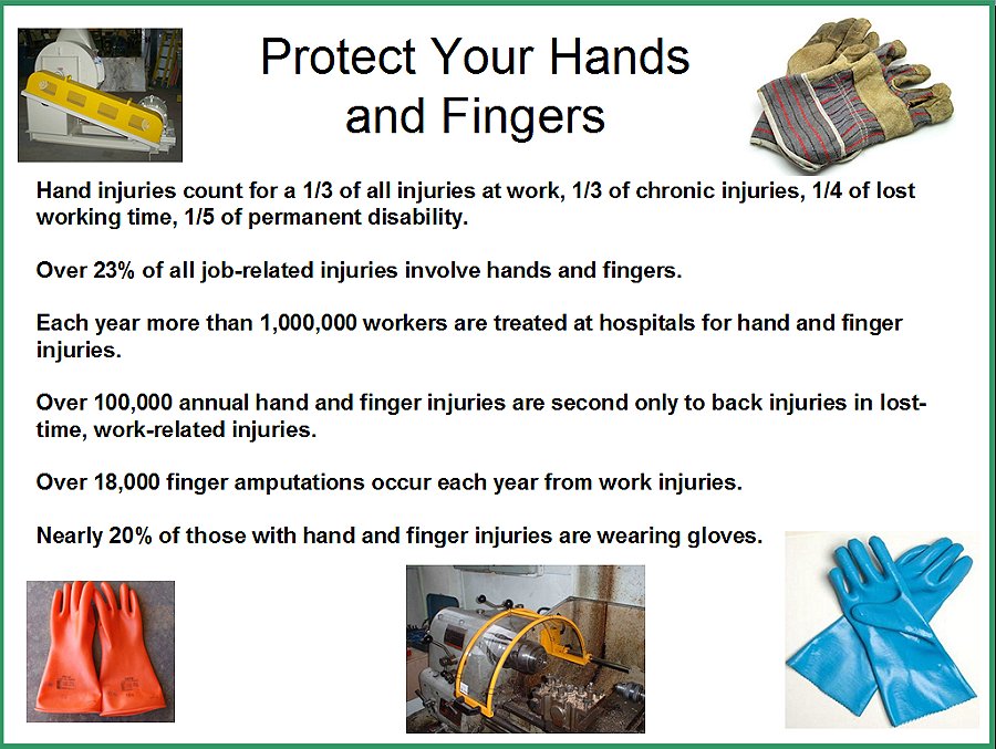Safety Blog: Fingers and Hands
