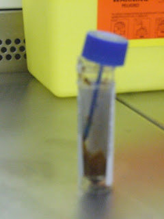 MadTechs: Occult Blood (OB) Test