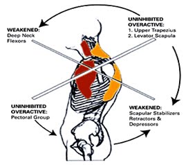 Rounding Third: Baseball Shoulder Injuries
