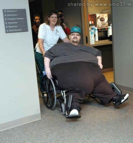 Foto Perjalanan Patrick Deuel, Menjadi Pria Tergemuk di Dunia - bigcendol