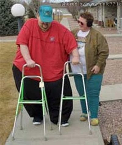 Foto Perjalanan Patrick Deuel, Menjadi Pria Tergemuk di Dunia - bigcendol