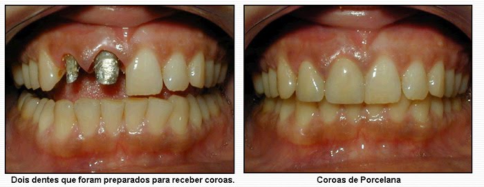 Blog da Ortodontia: agosto 2010