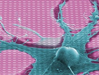 Science is interesting: Neuro-Chips